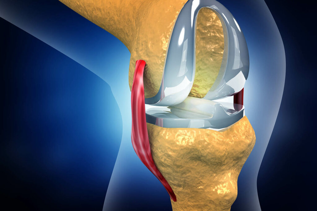 A Complete Knee Replacement Procedure And Recovery