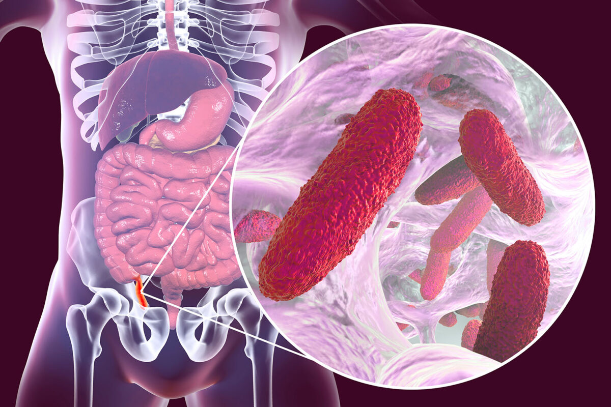 Appendectomy Cause - Eremedium