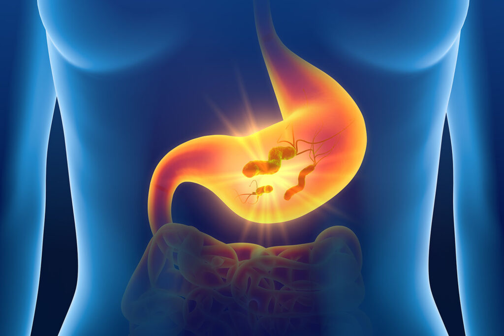 Gastritis Treatments - Eremedium