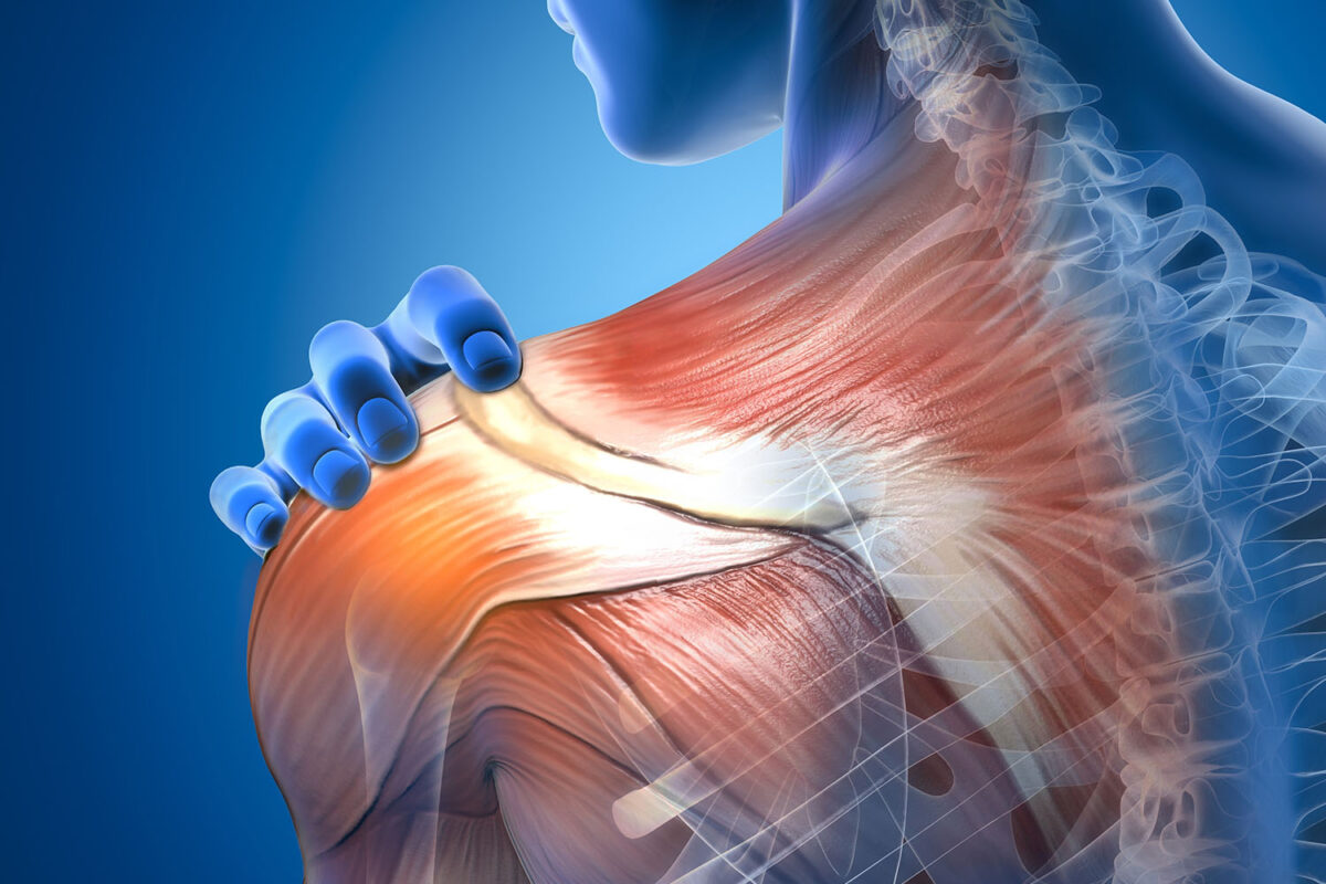 How to Diagnose and Treat a Hip Labral Tear