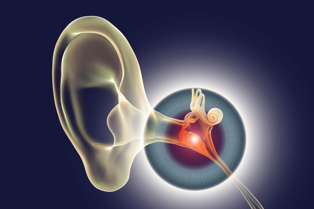 Otitis Media with Effusion - Eremedium