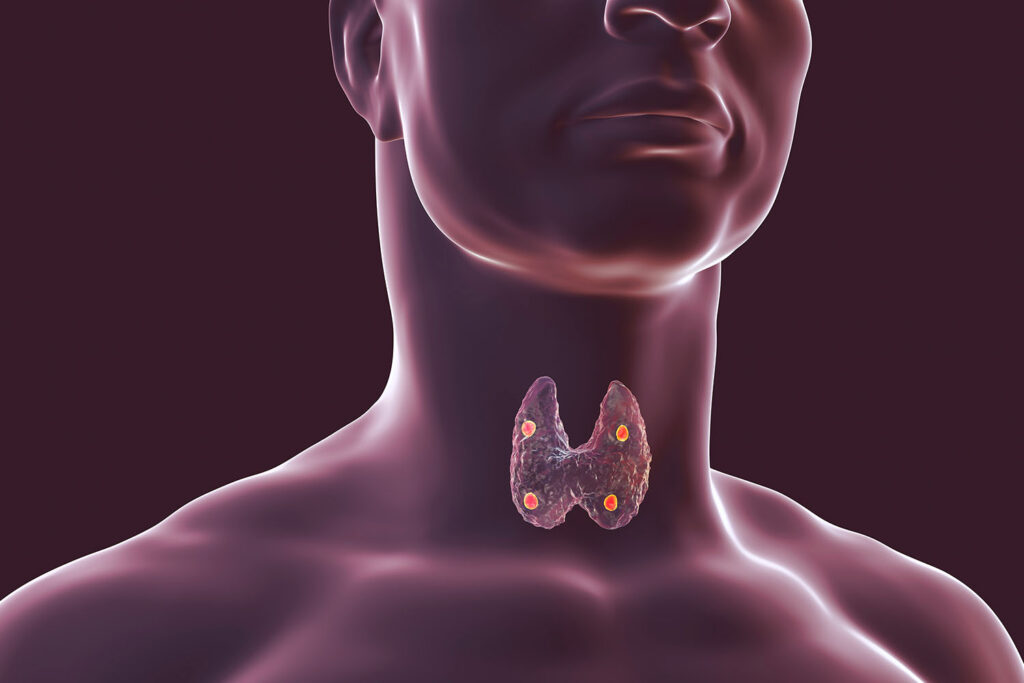 Parathyroidectomy - Eremedium