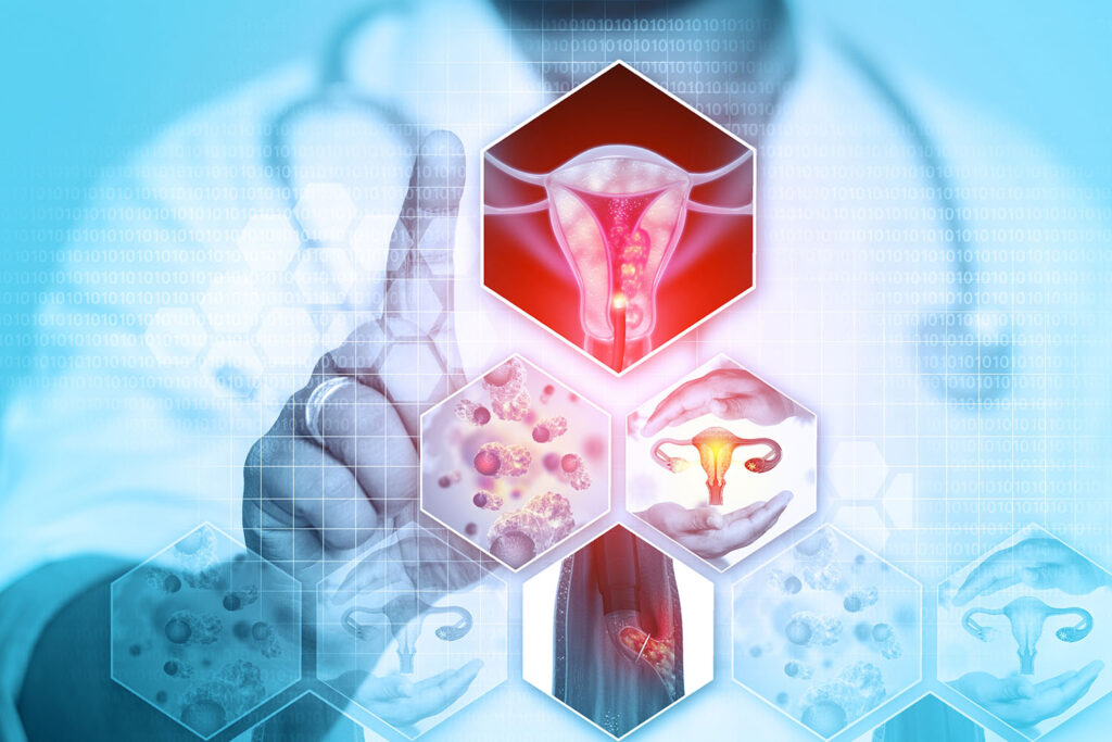 Partial Hysterectomy - Eremedium