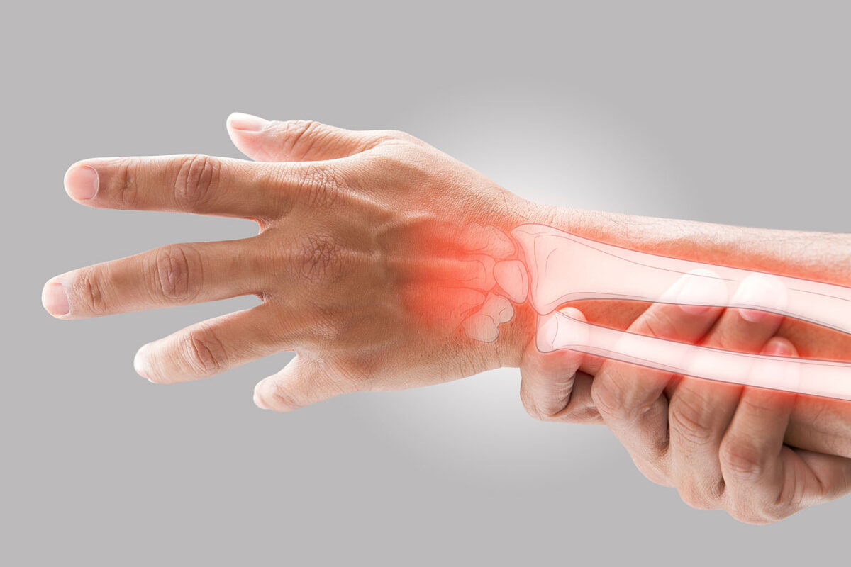 Hand Fracture Pic - Eremedium