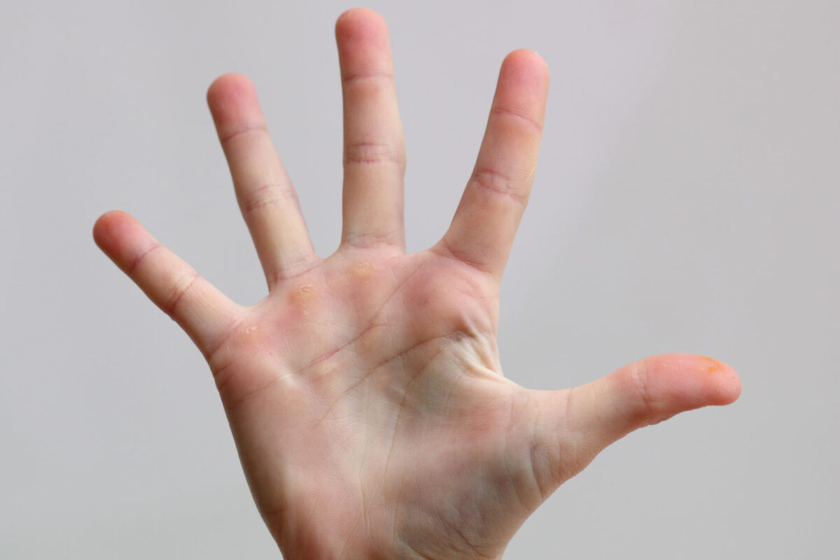 Hand Parts Name - Eremedium