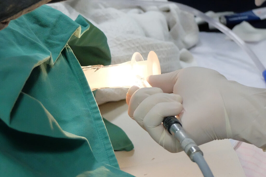 Proctoscopy - Eremedium