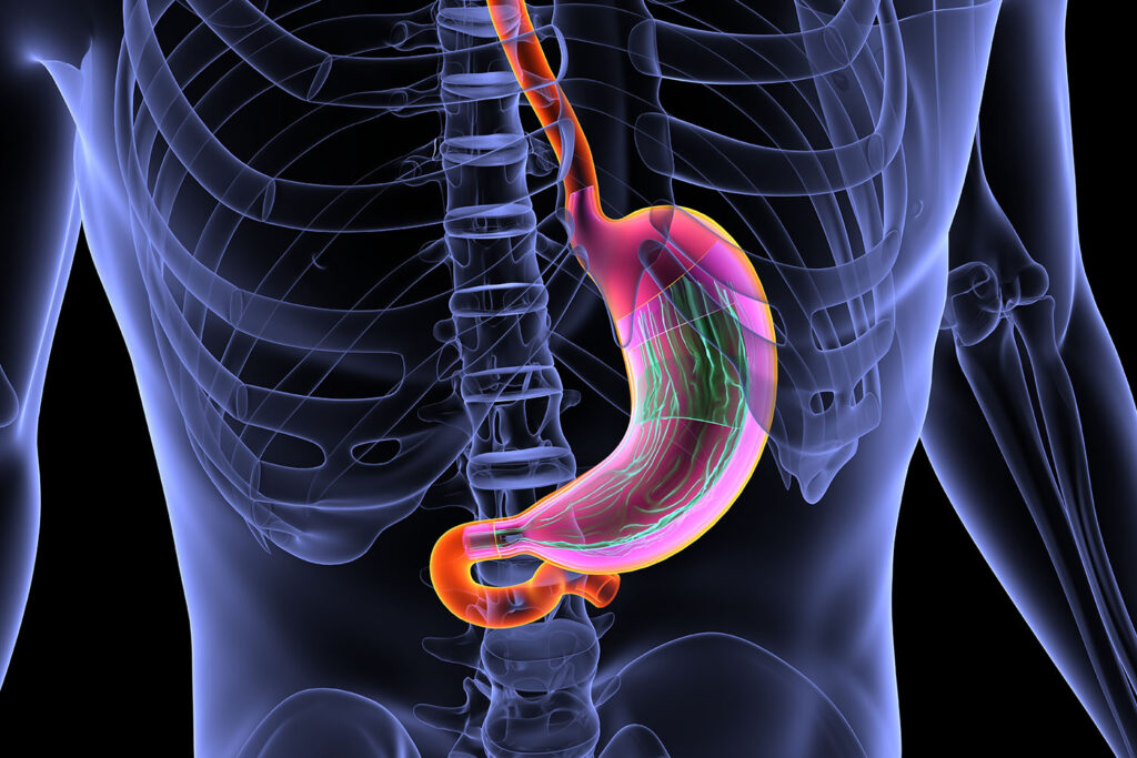 Antrum of Stomach - Eremedium