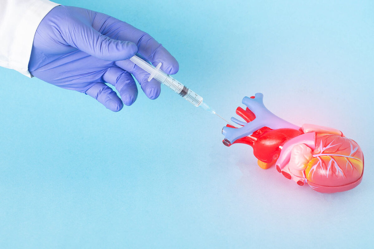 TMR Full Form - Eremedium